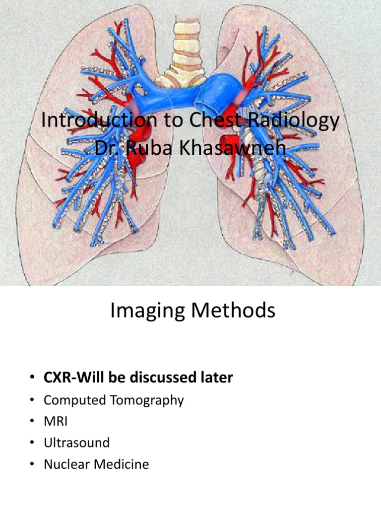 Chest Anatomy. Chest Anatomy | PDF | Lung | Ct Scan