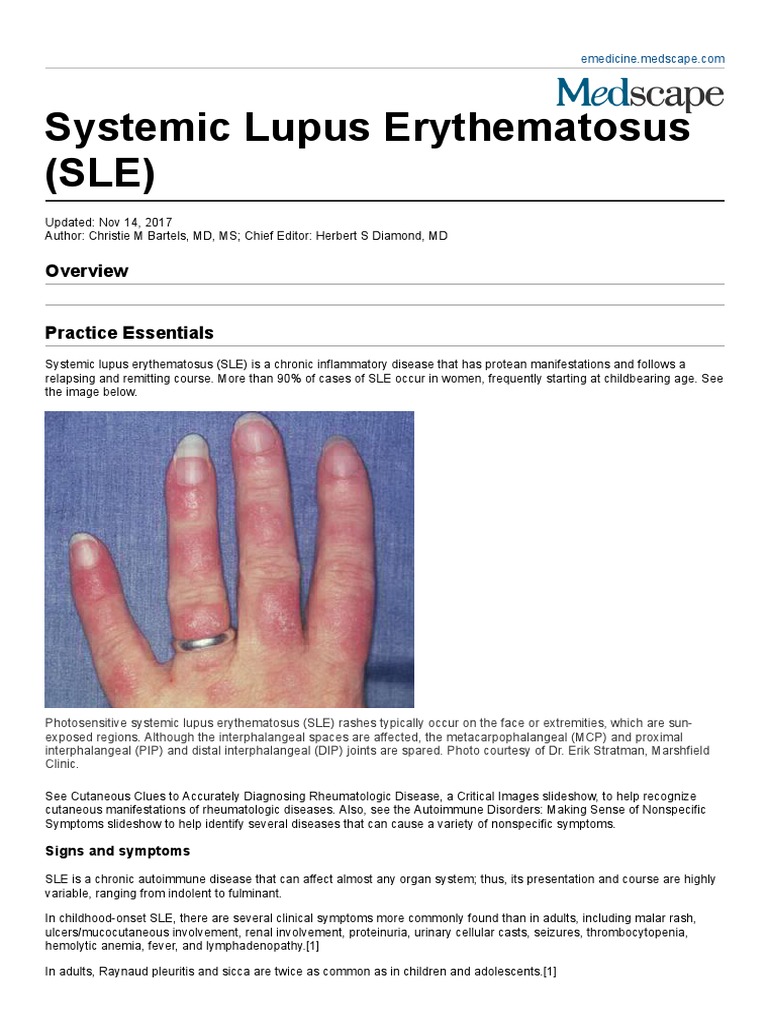 SLE Medscape | PDF | Systemic Lupus Erythematosus | Immune System