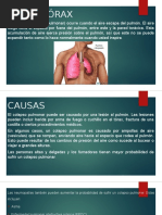 Bullas y Cavernas en Lesiones Pulmonares | PDF | Pulmón | Ct Scan