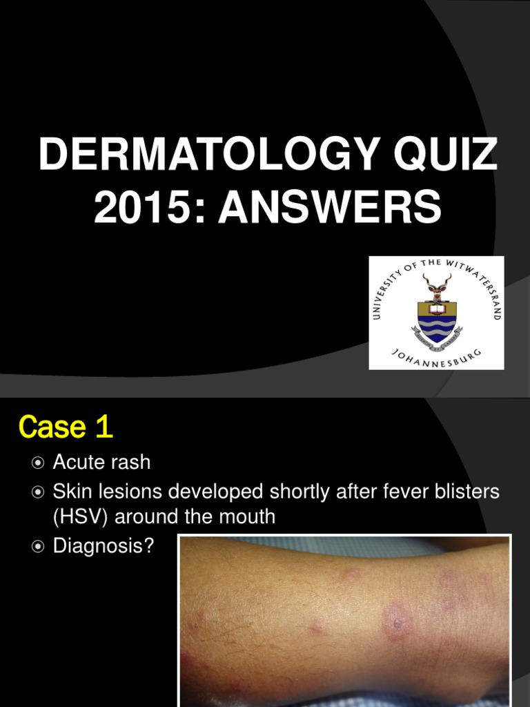 Dermatology Quiz 2015 Answers | PDF