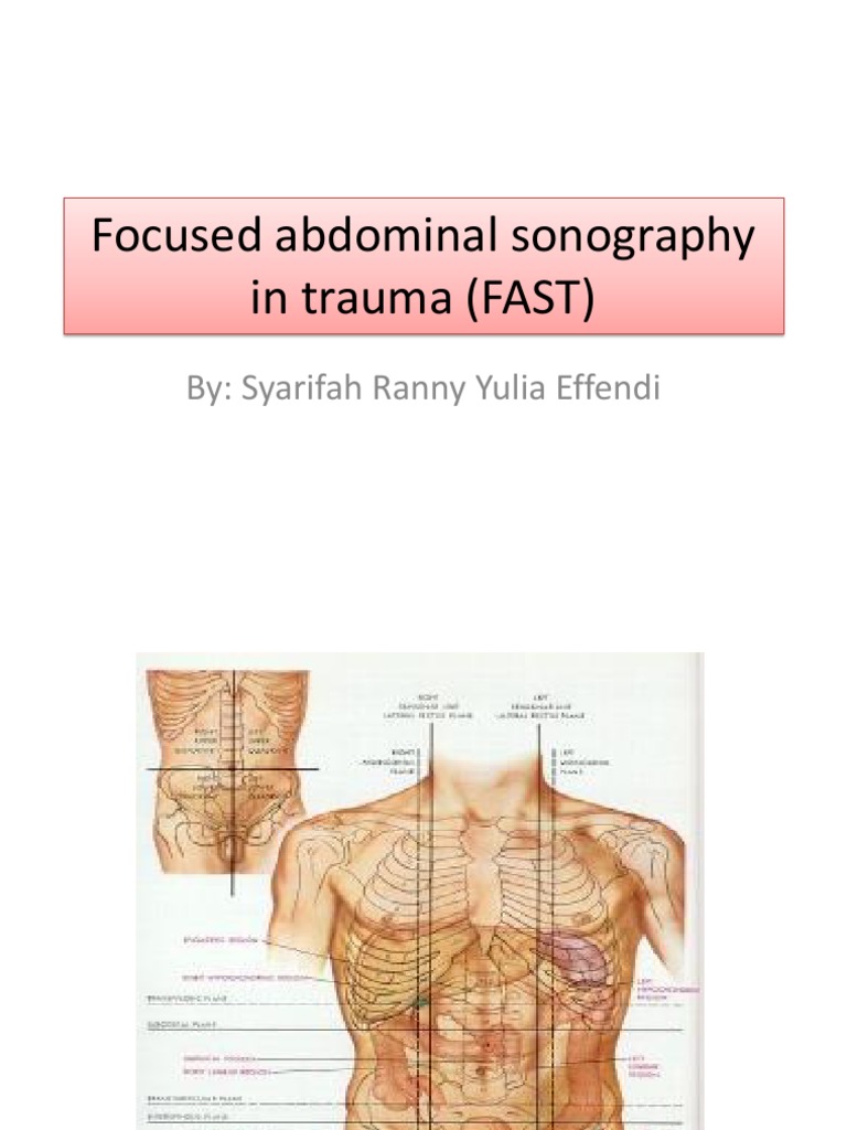Focused Abdominal Sonography in Trauma (FAST) | PDF | Medical ...