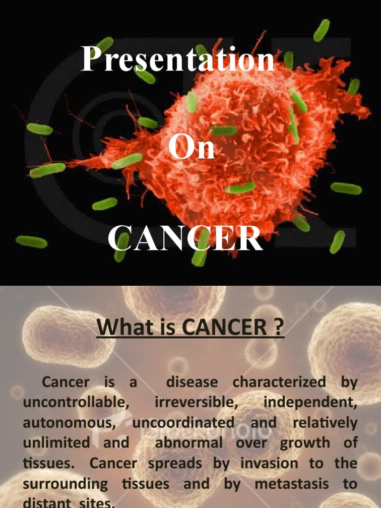Cartoon | PDF | Metastasis | Cancer