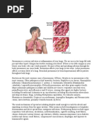 PCAP Pediatric Community Acquired Pneumonia PATHOPHYSIOLOGY | PDF ...