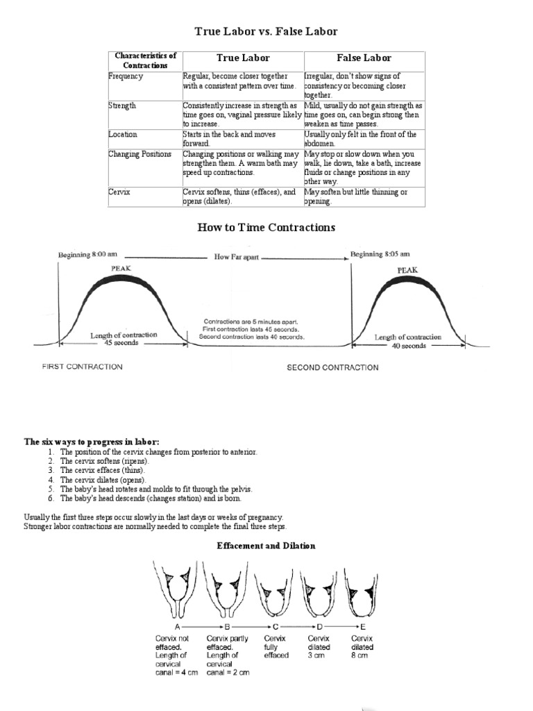 Understanding the Differences Between True Labor and False Labor ...