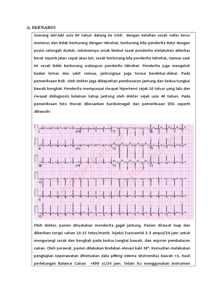 Skenario Mahasiswa Ipe | PDF