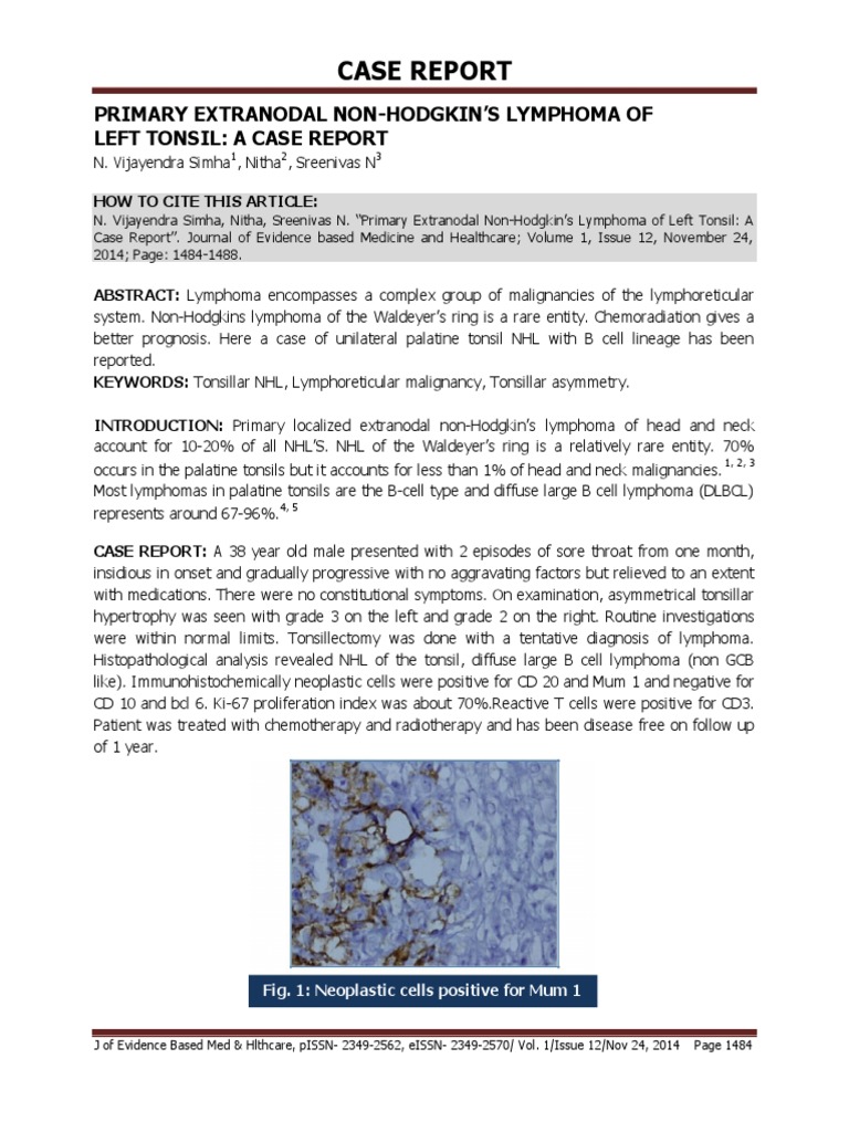 Jurnal Tonsil Limfoma Non Hodgkin | PDF | Lymphoma | Head And Neck Cancer