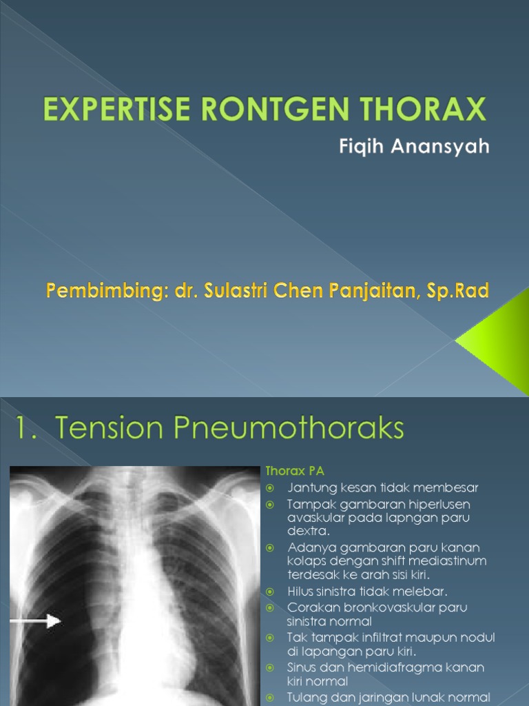 Diagnosa Rontgen Thorax: 10 Kasus | PDF