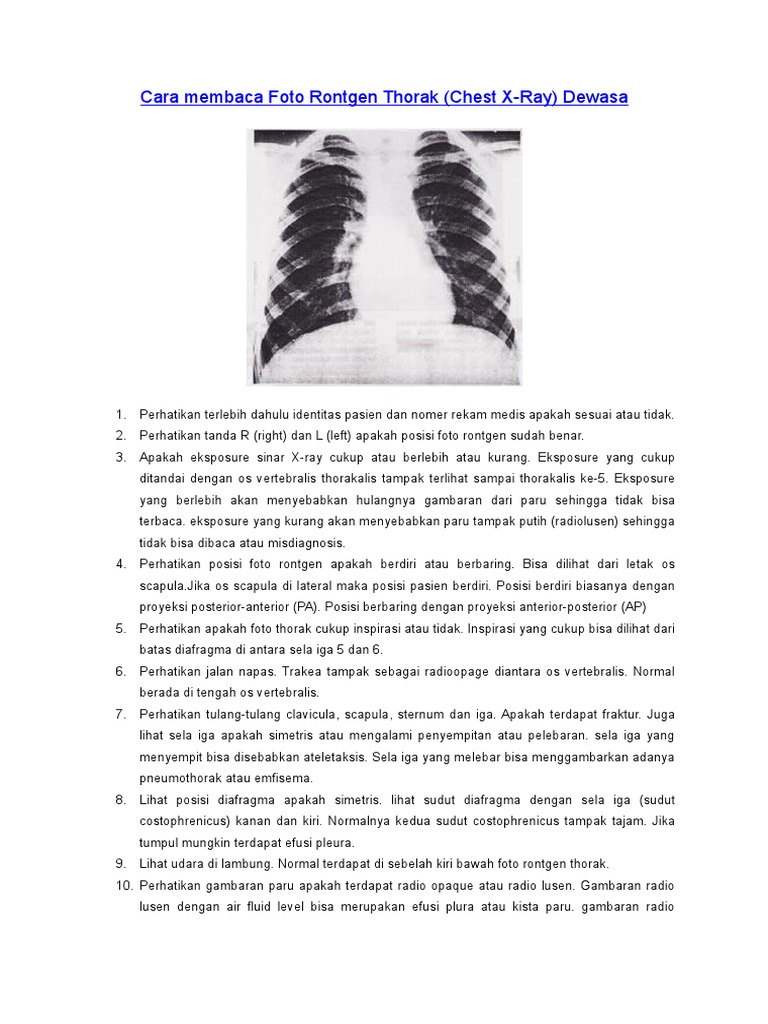 Cara Membaca Foto Rontgen Thorak | PDF
