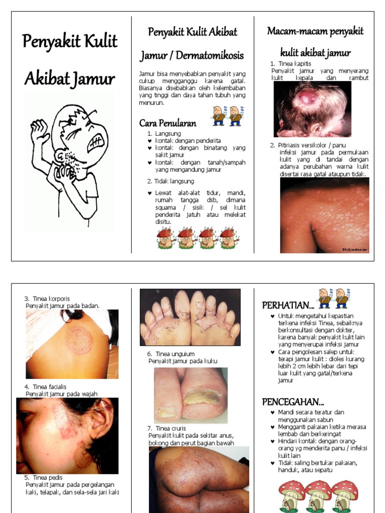 Poster Hemoroid | PDF