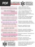 EKG para Dummies | PDF | Electrocardiografia | Medicina Interna