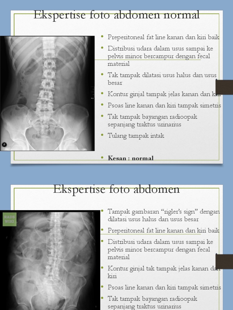 Radiologi Abdomen | PDF