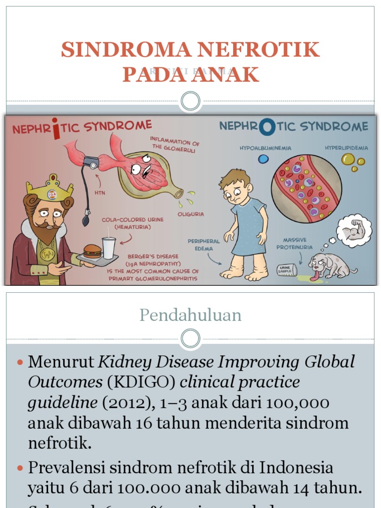Sindroma Nefrotik Pada Anak | PDF