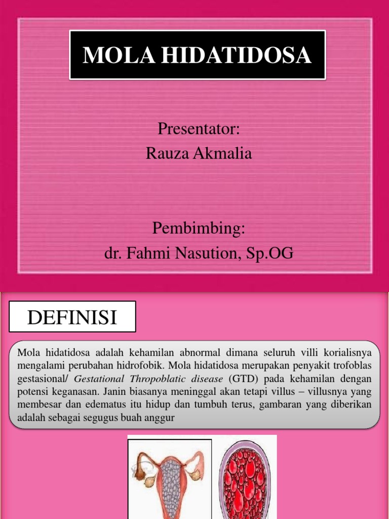 Referat Mola Hidatidosa | PDF | Sains & Matematika