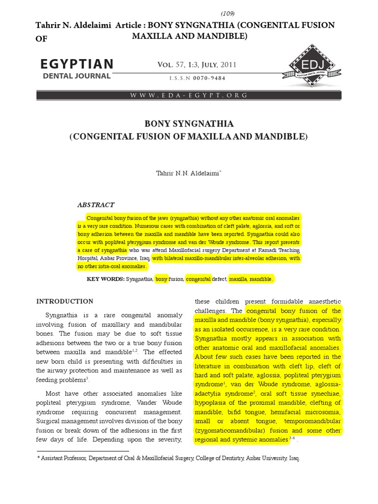 3.tahrir N. Aldelaimi Article Bony Syngnathia (Congenital Fusion of ...