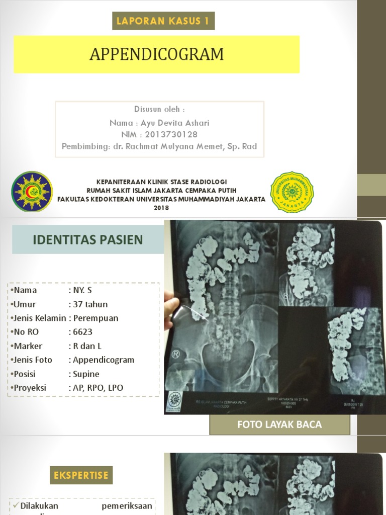 Radiologi Appendisitis | PDF | Sains & Matematika