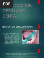 Técnica de Bass Modificada | PDF | Diente | Odontología