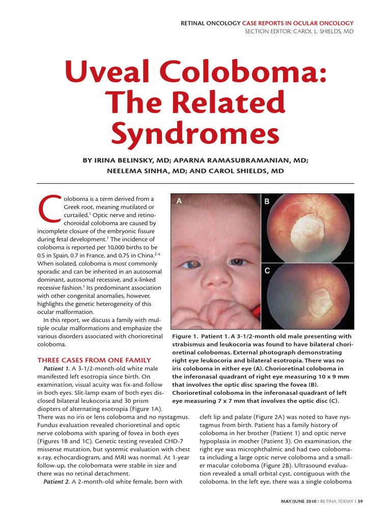 Uveal Coloboma: The Related Syndromes | Download Free PDF | Diseases Of ...