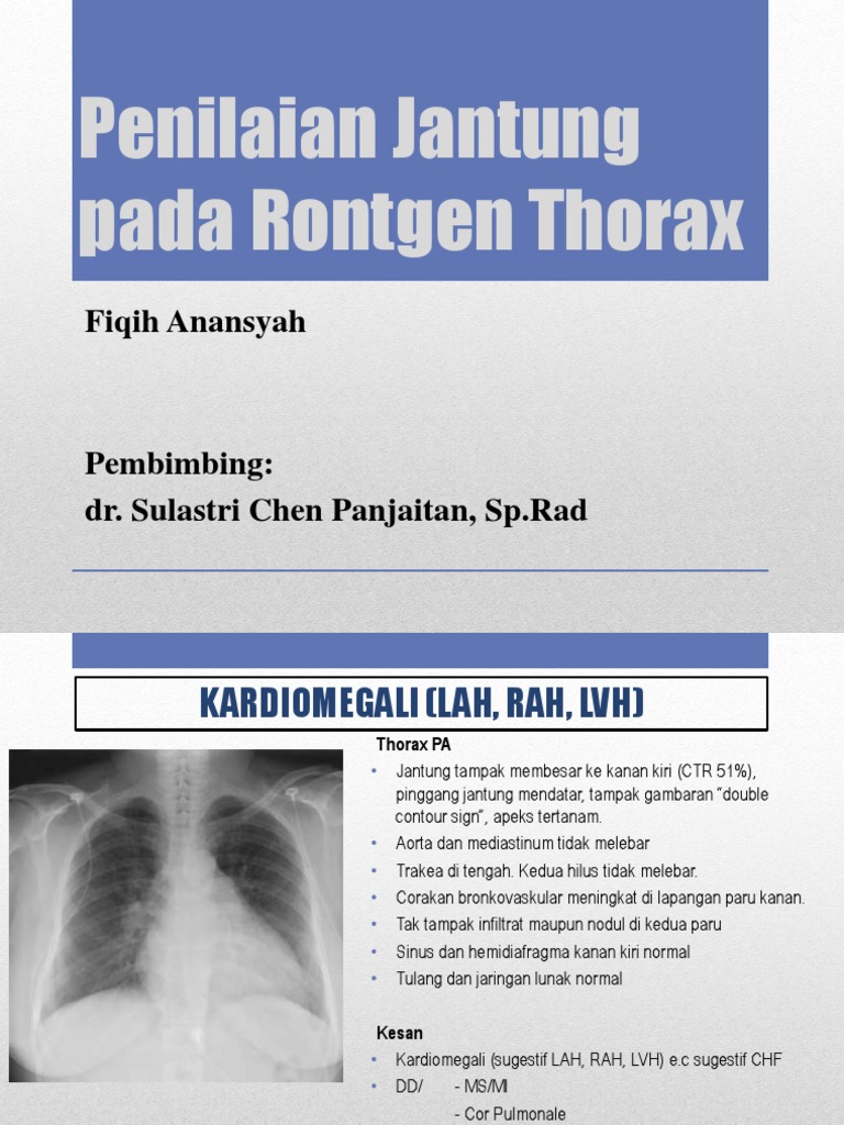 Fiqih Anansyah, Expertise Jantung Ro. Thorax | PDF
