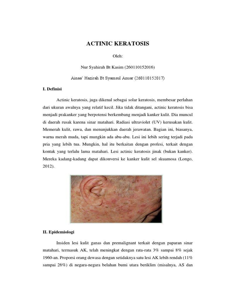 Actinic Keratosis | PDF