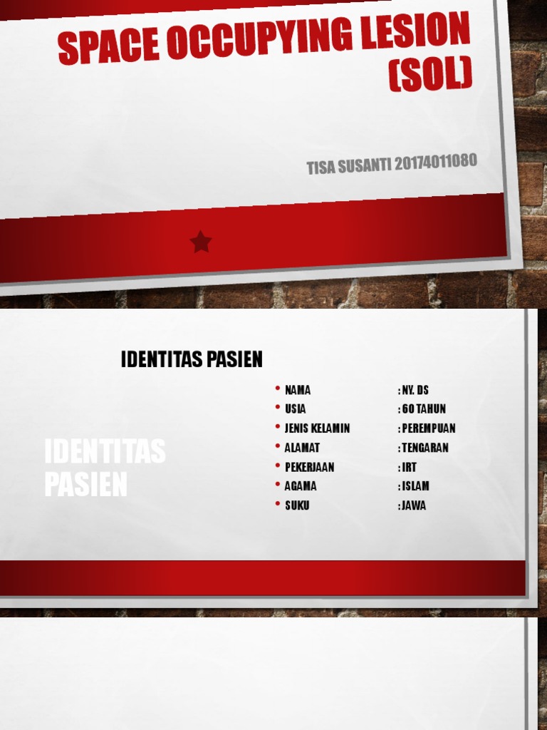 Space Occupying Lesion (Sol) | PDF