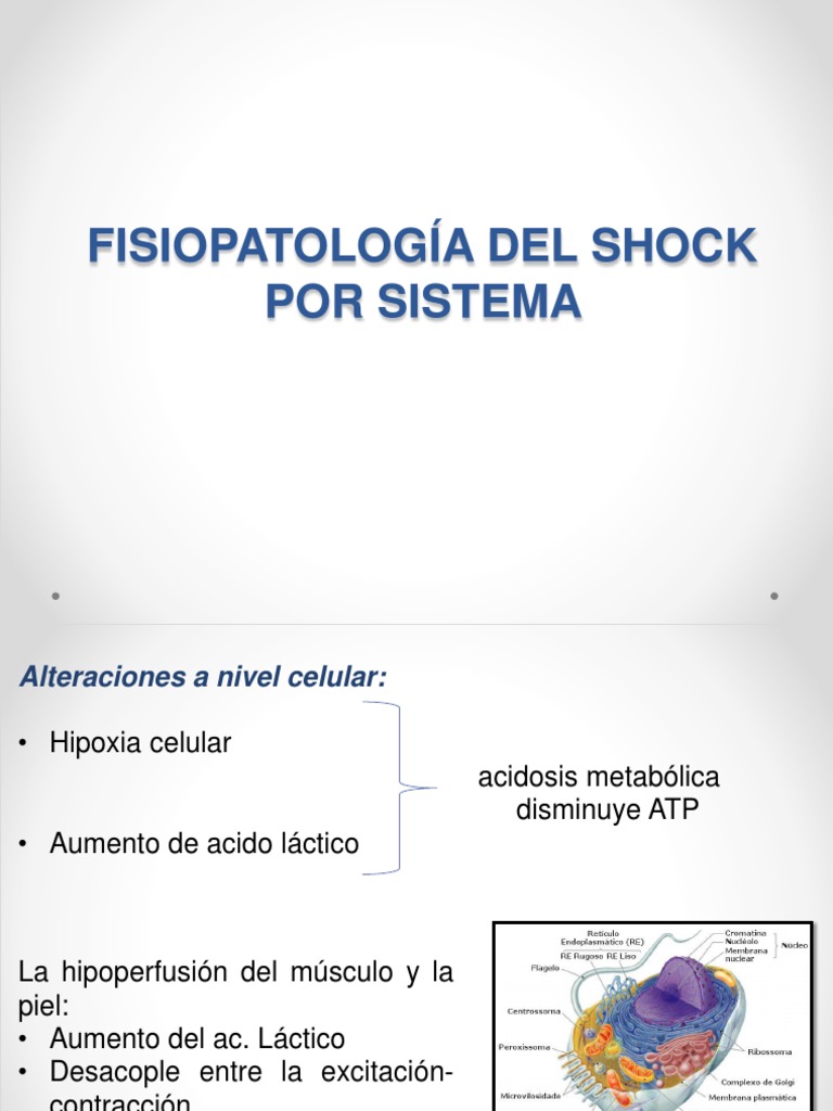 Shock Cardiogenico | PDF | Choque (circulatorio) | Corazón
