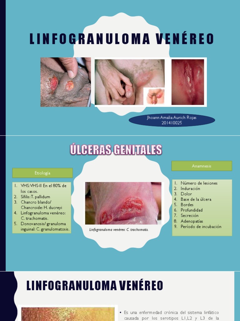 Una revisión sobre el linfogranuloma venéreo: manifestaciones clínicas ...