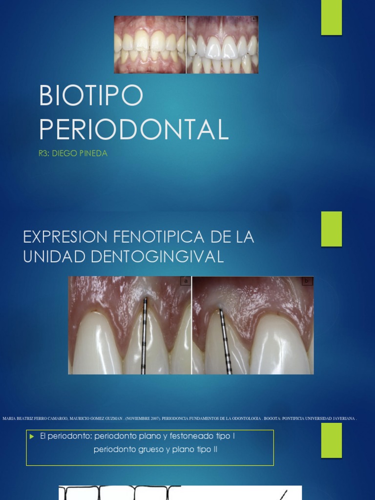 BIOTIPO PERIODONTAL.pptx | Ortodoncia | Odontología