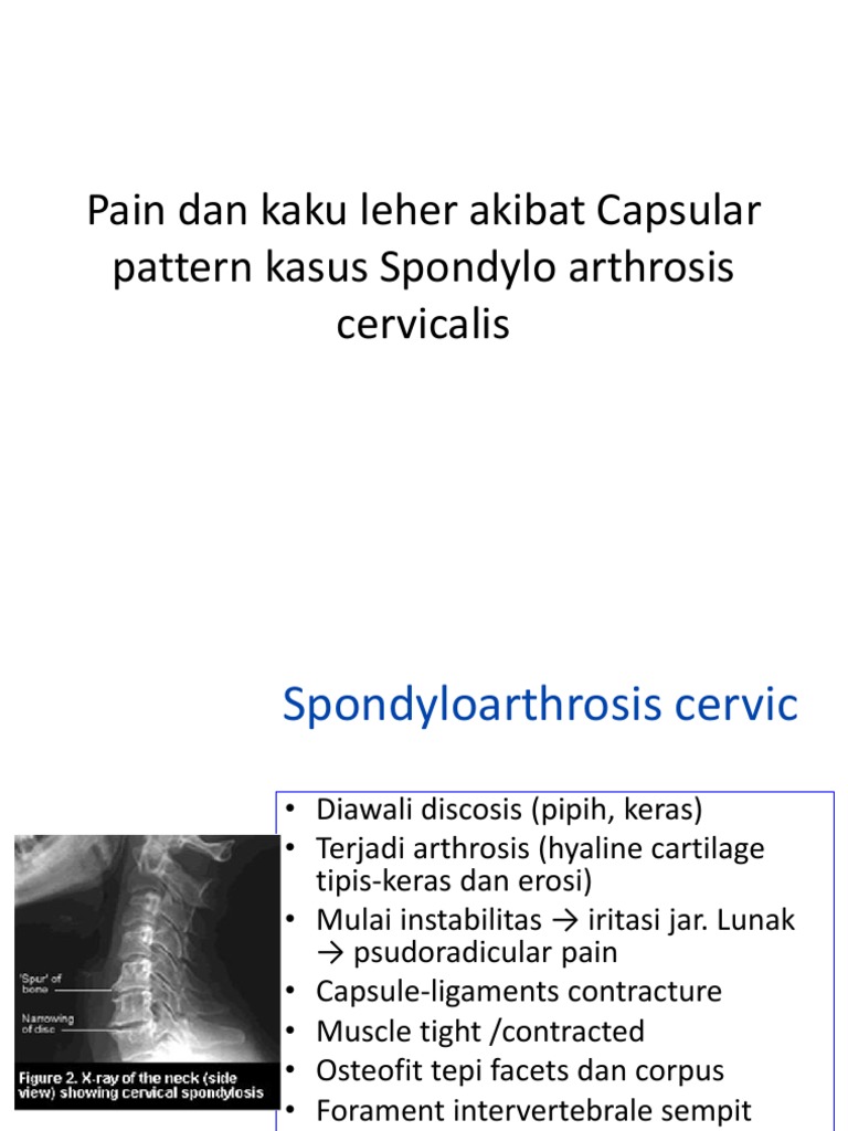 Pain Dan Kaku Leher Akibat Capsular Pattern Kasus SAC | PDF ...