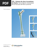 Endobutton CL Ultra TECNICA v2 | PDF | Extremidades (anatomía ...