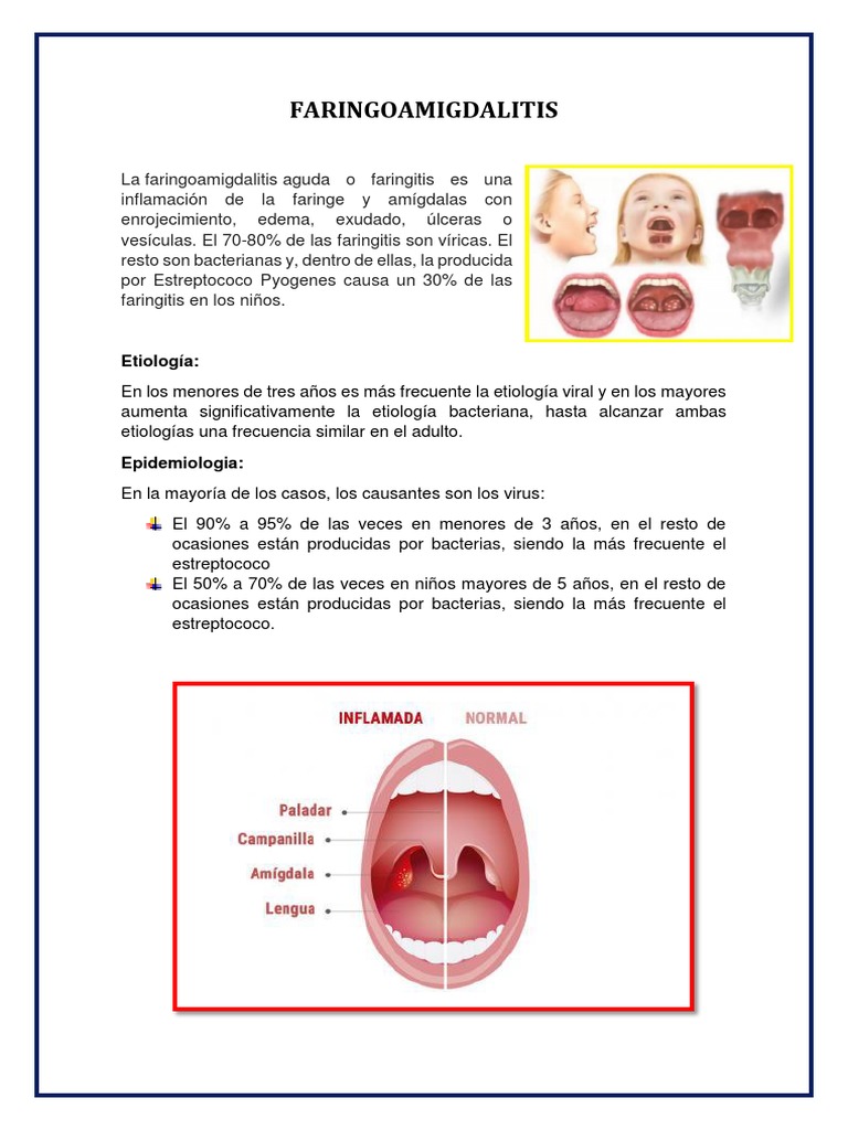 FARINGOAMIGDALITIS | PDF | Rtt | Epidemiología