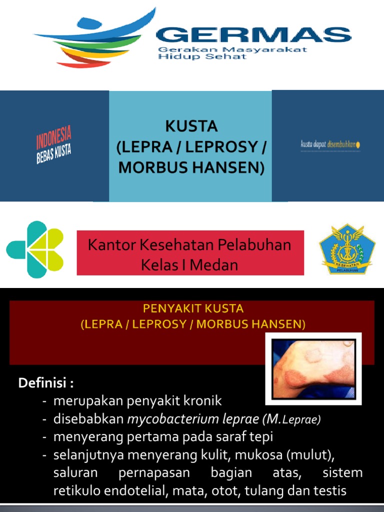 Powerpoint Kusta | PDF