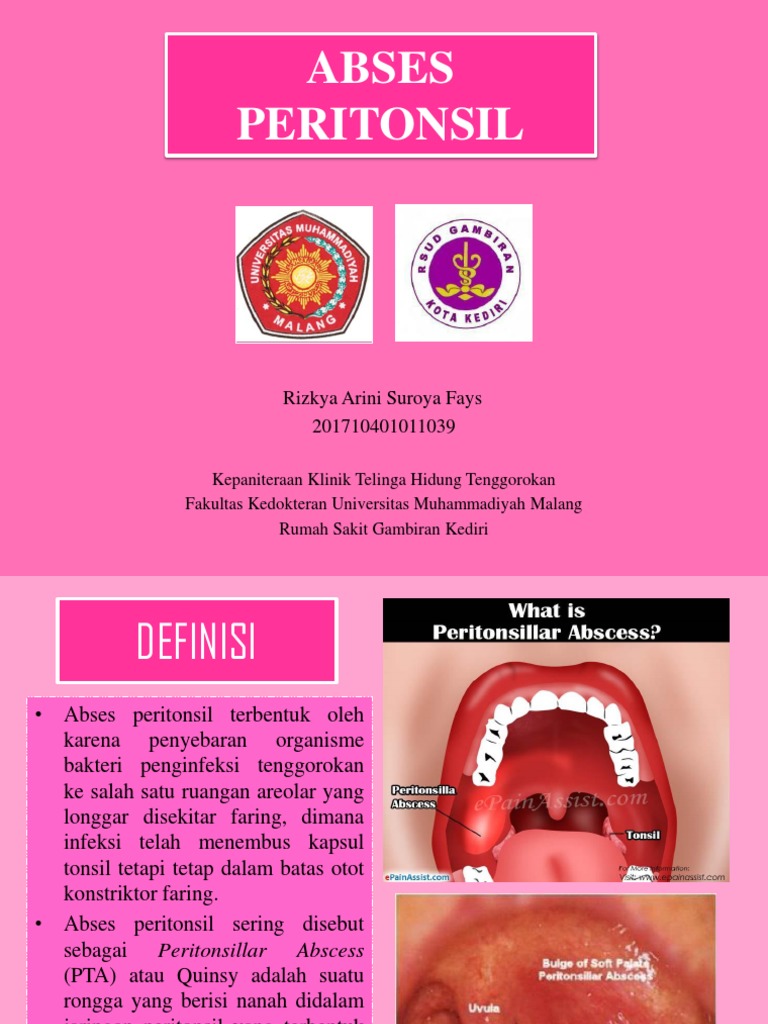 ABSES PERITONSIL Ririn | PDF