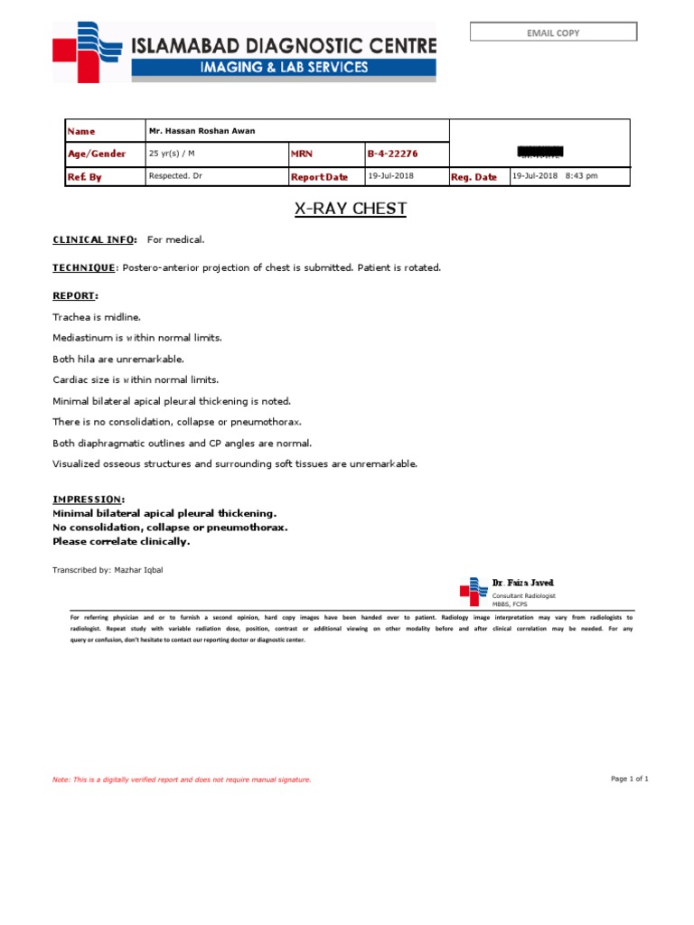 X-Ray Chest PA View | PDF