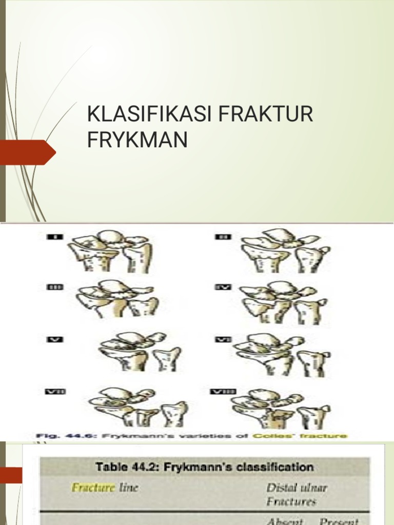 Klasifikasi Fraktur Frykman | PDF