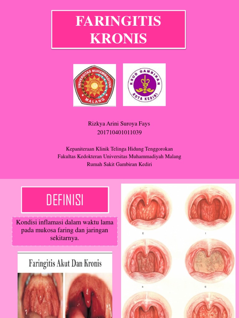 Faringitis Kronis: Definisi dan Tatalaksana | PDF