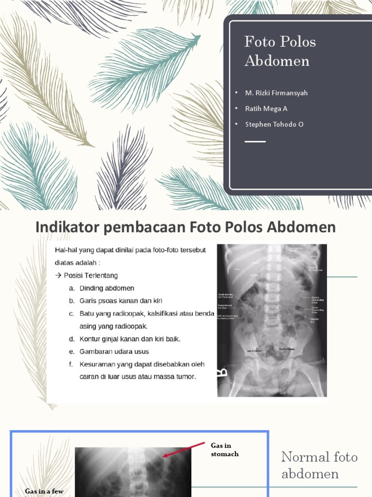 Foto Polos Abdomen | PDF | Abdomen | Peritoneum