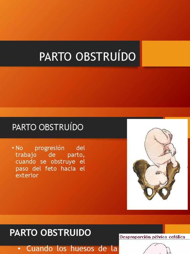 Parto Obstruido | PDF | Parto | Pelvis