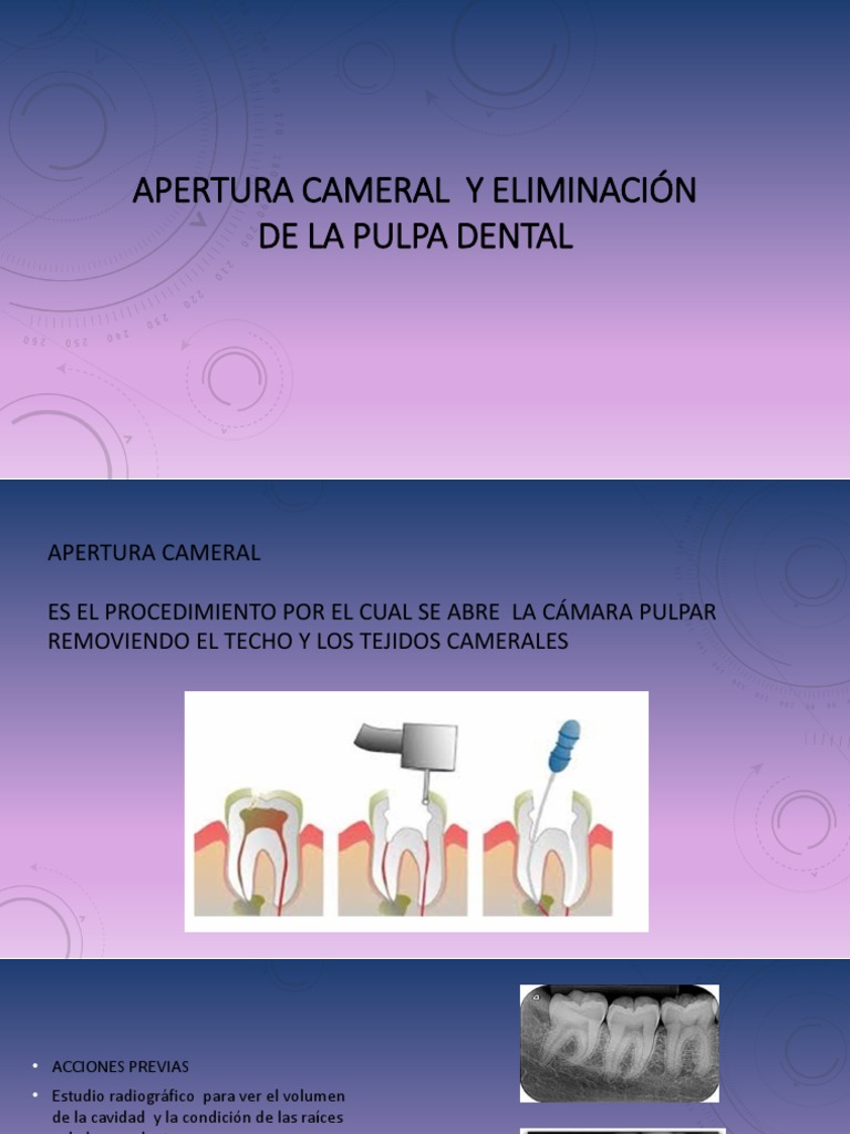 Apertura Cameral. | PDF | Anatomia animal | Diente