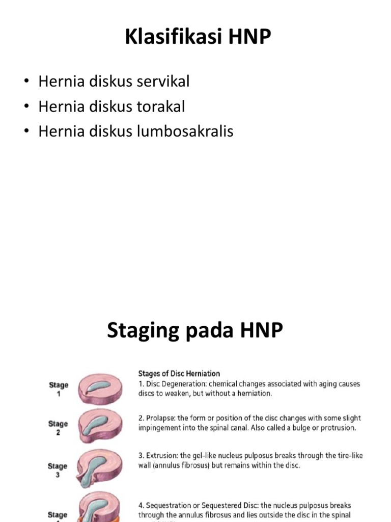 Klasifikasi dan Staging HNP Lumbal | PDF | Sains & Matematika