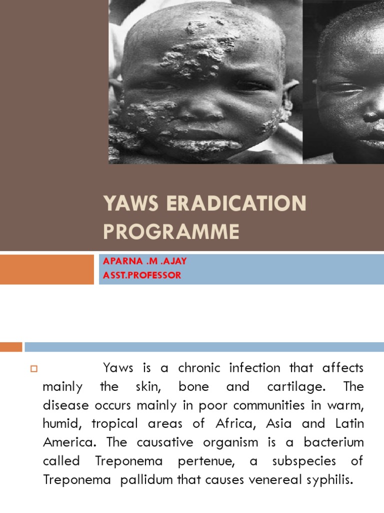 Yaws Eradication Programme Overview | PDF | Eradication Of Infectious ...