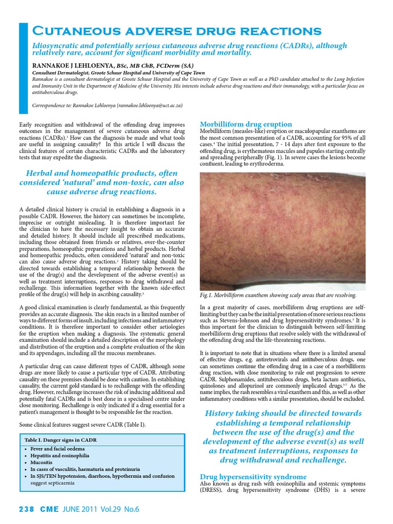 Managing Severe Cutaneous Drug Reactions | PDF | Medicine | Clinical ...
