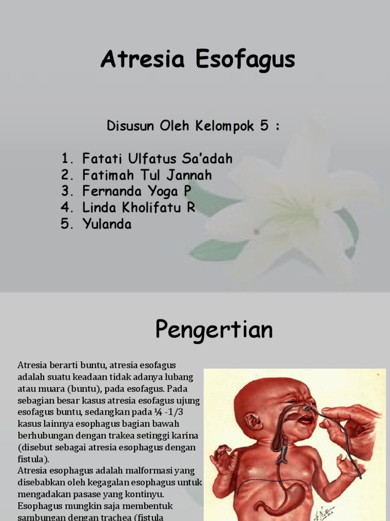 Atresia Esofagus | PDF