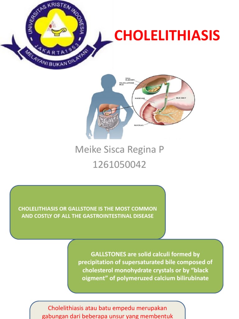 Penanganan Cholelithiasis dan Diagnostik | PDF