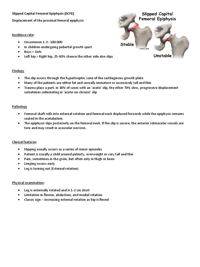 Slipped Capital Femoral Epiphysis - SCFE | PDF | Hip | Anatomical Terms ...