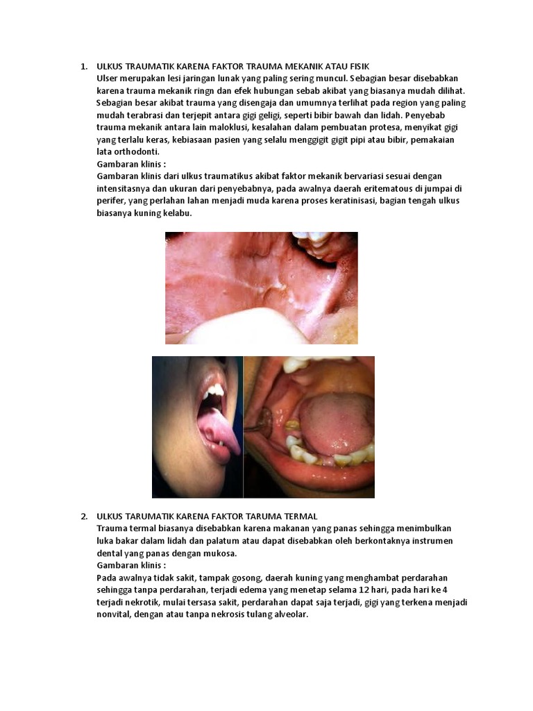 Gambaran Klinis Ulkus Traumatikus | PDF