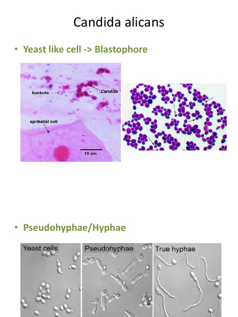 Candida Albicans | PDF | Candidiasis | Dermatology