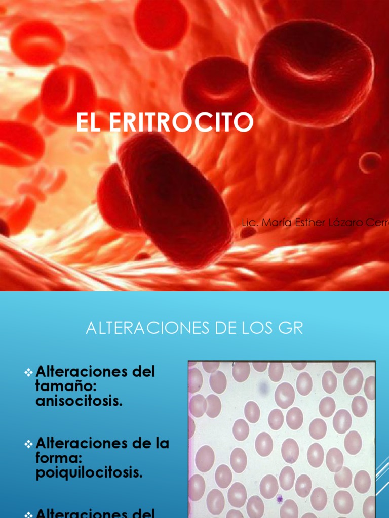 6. Reticulocitos Constantes Corpusculares Ipm | Fluidos corporales ...