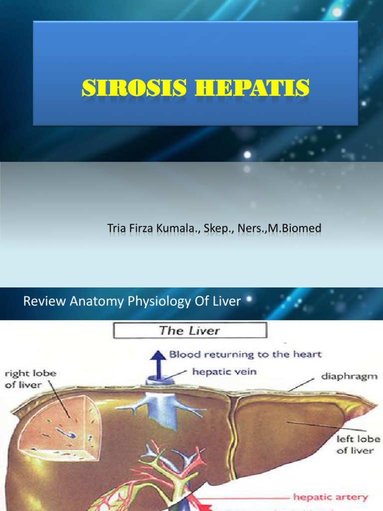 Sirosis Hepatis.pptx | Liver | Cirrhosis