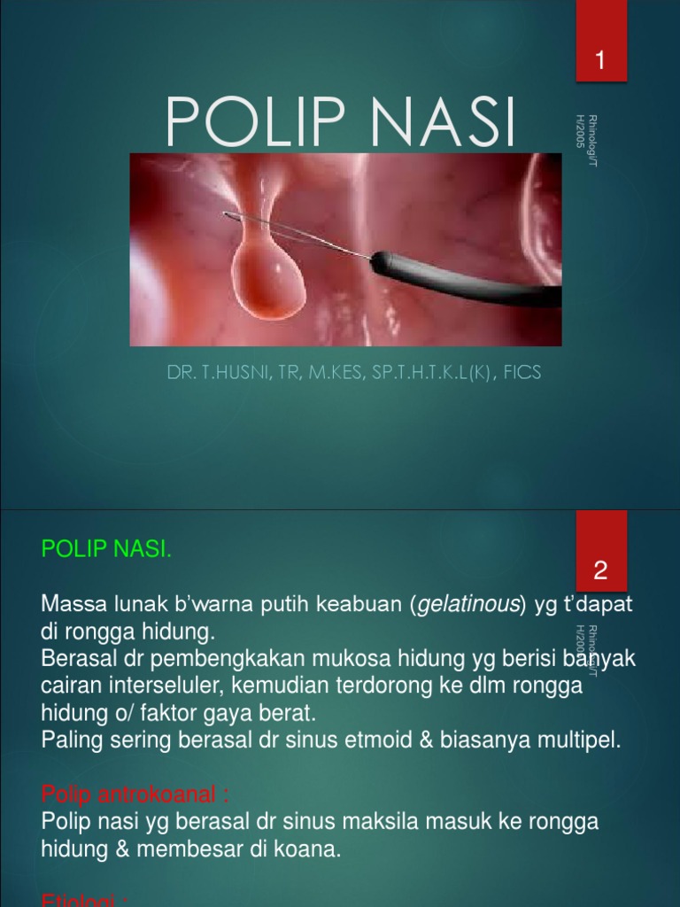 Polip Nasi: Ciri dan Penanganan | PDF | Sains & Matematika
