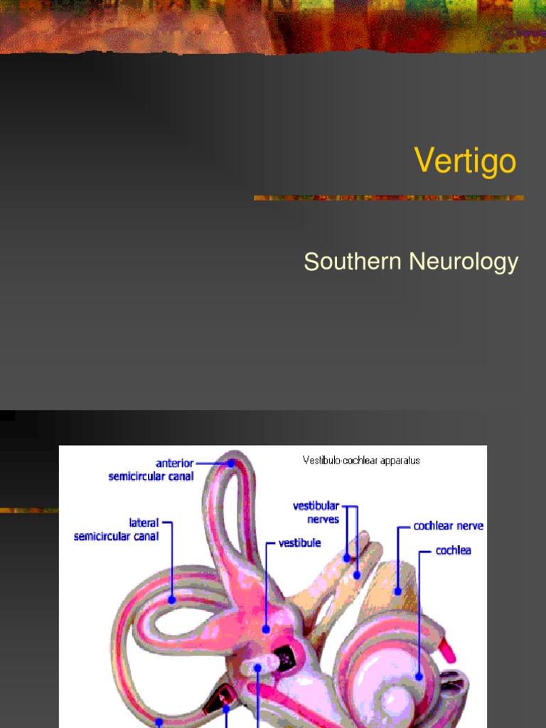 Vertigo | PDF | Vertigo | Vestibular System